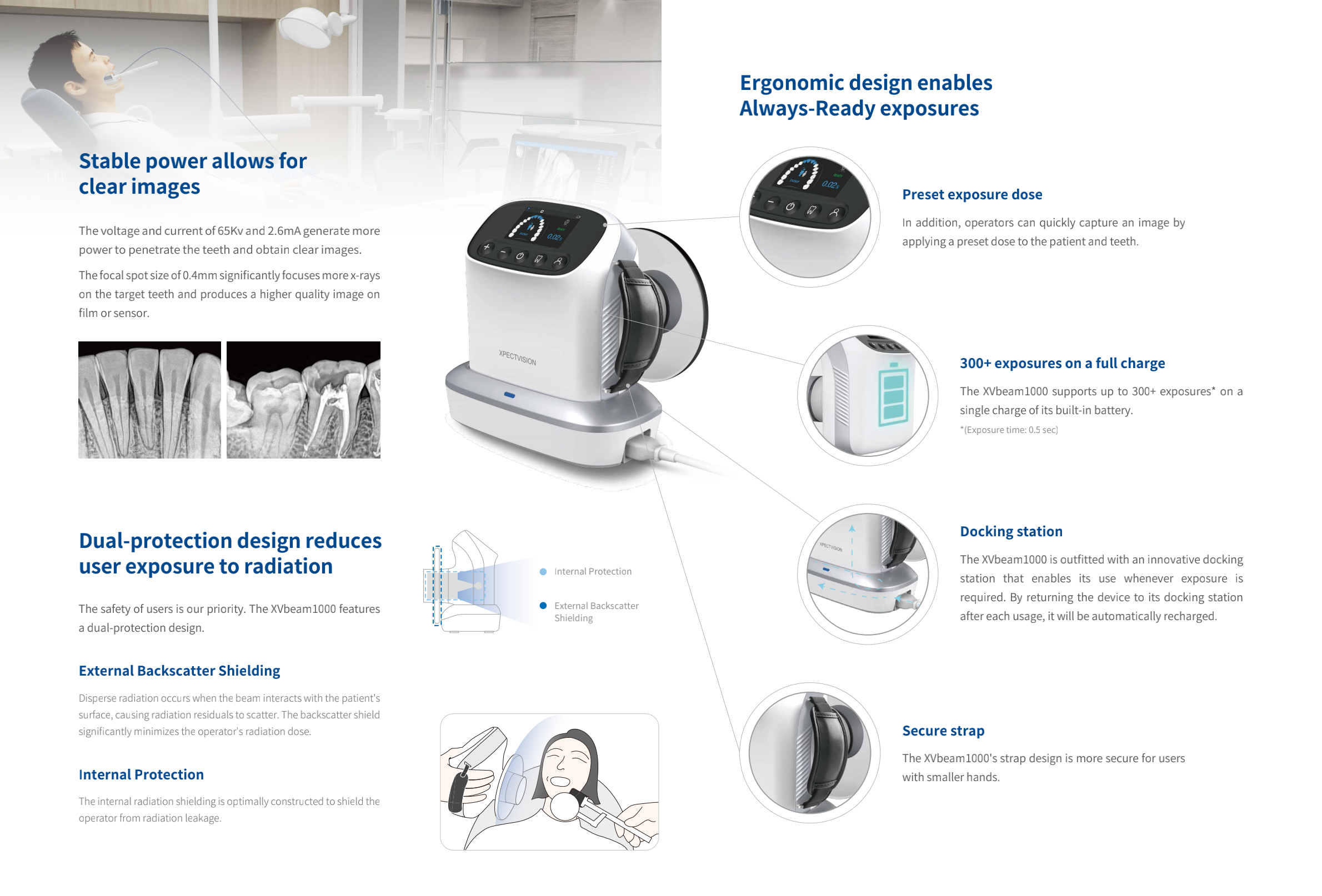 Xpect Vision Portable X-ray | Teeth Tech Ecommerce